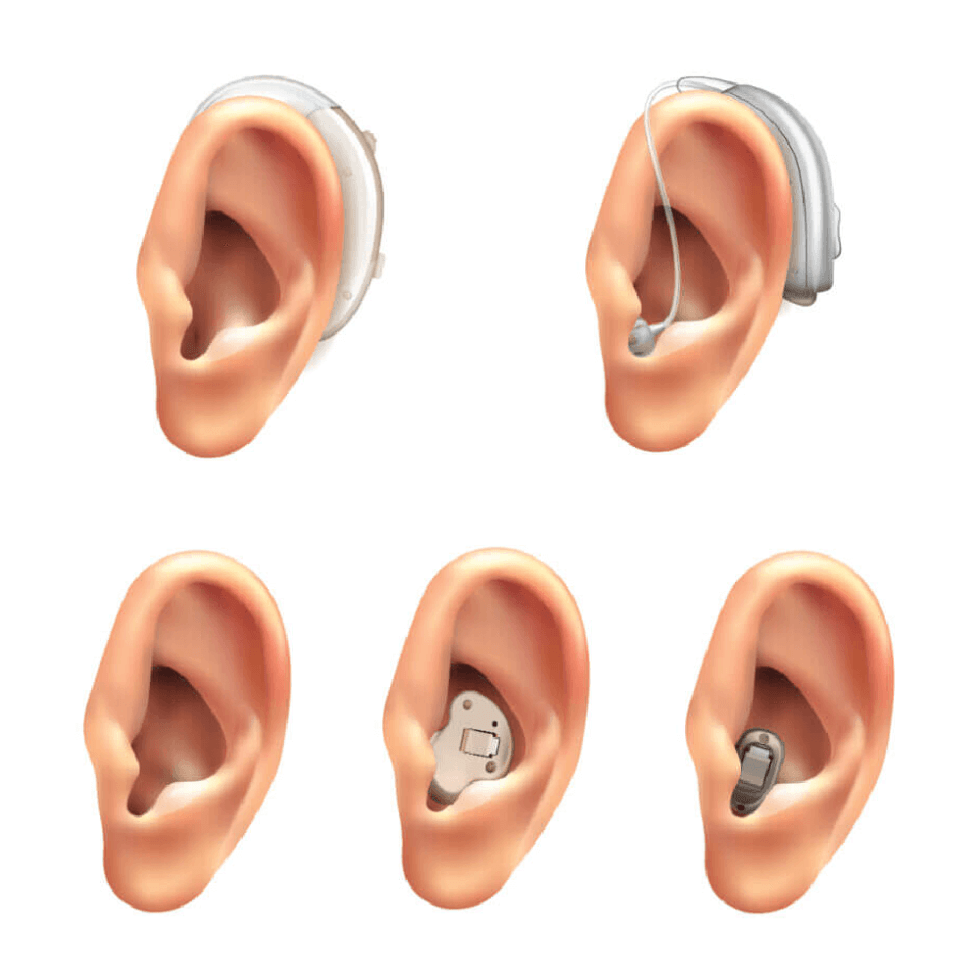 Hearing Aids At Pragyan CDC – Top Brands & Free Consultation